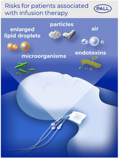 Iv Infiltratie Diagram