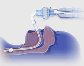 Breathing filtration | Cytiva