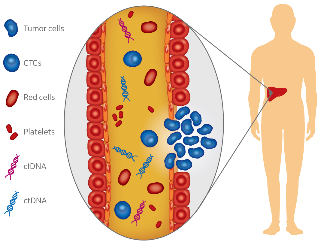 Liquid biopsy: game-changer? | Cytiva
